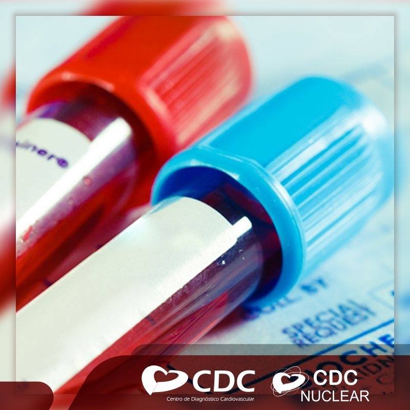 Exames Laboratoriais - CDC